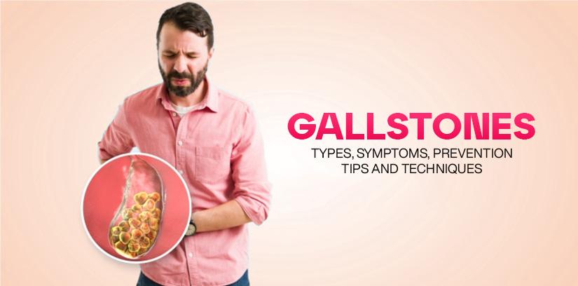 Gallstones: Types, Symptoms, Prevention Tips, and Techniques